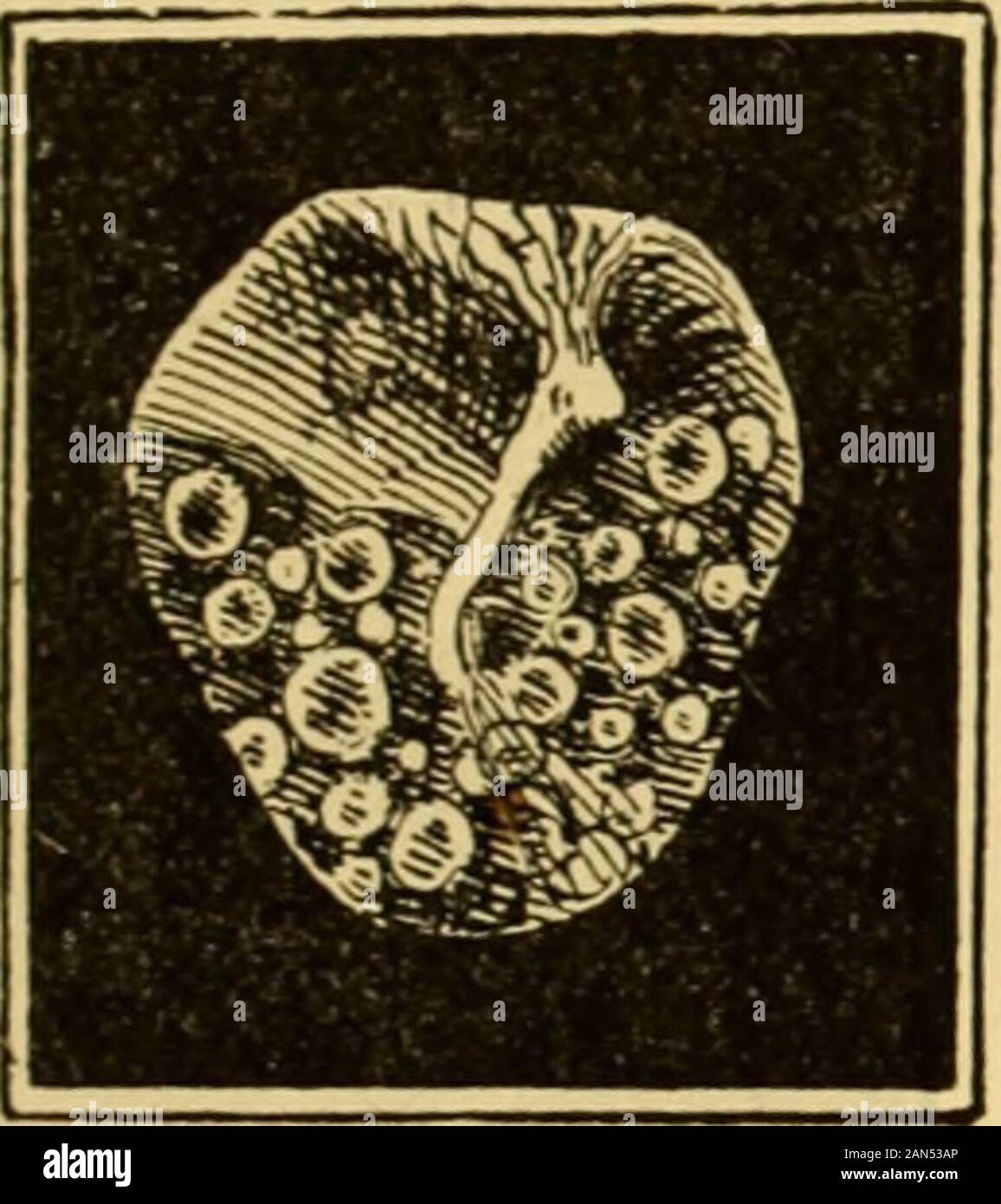 Tympanic membrane normal hi-res stock photography and images - Alamy