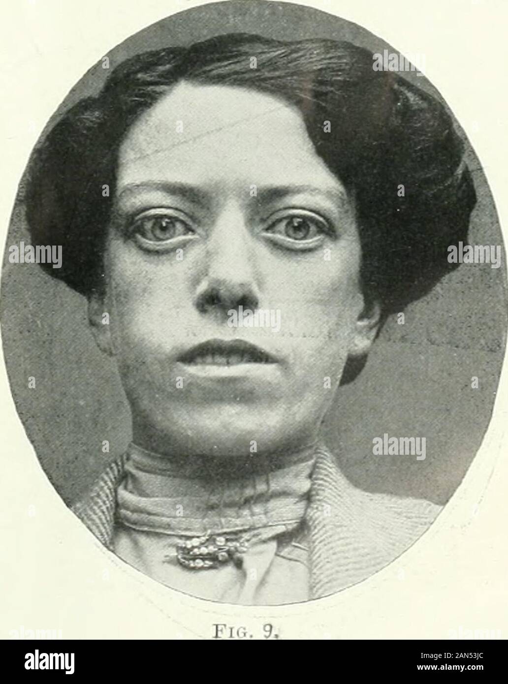 British medical journal . Fig. 8.. The Bhitish *|Medical Joubxai, J ...