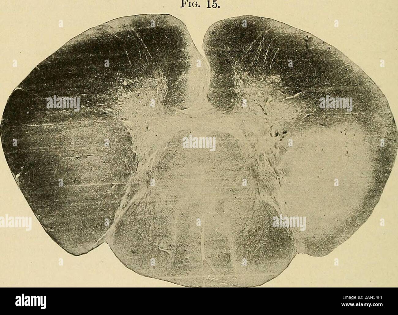 Organic and functional nervous diseases; a text-book of neurology ...