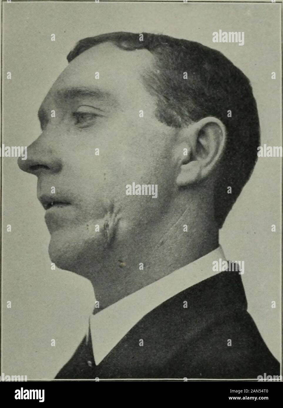 Dental extraction methods hi-res stock photography and images - Alamy