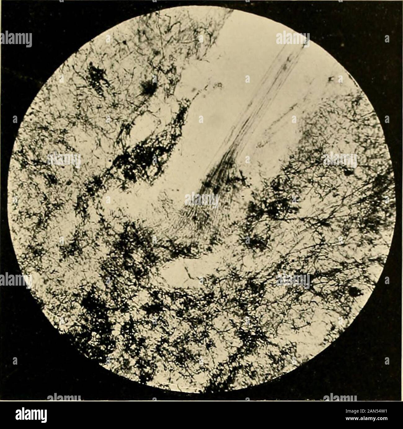 Ringworm in the light of recent research : pathology, treatment ...