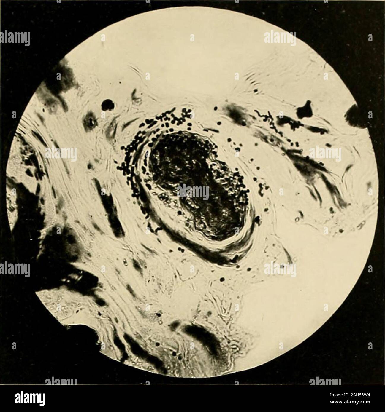 Ringworm in the light of recent research : pathology, treatment ...
