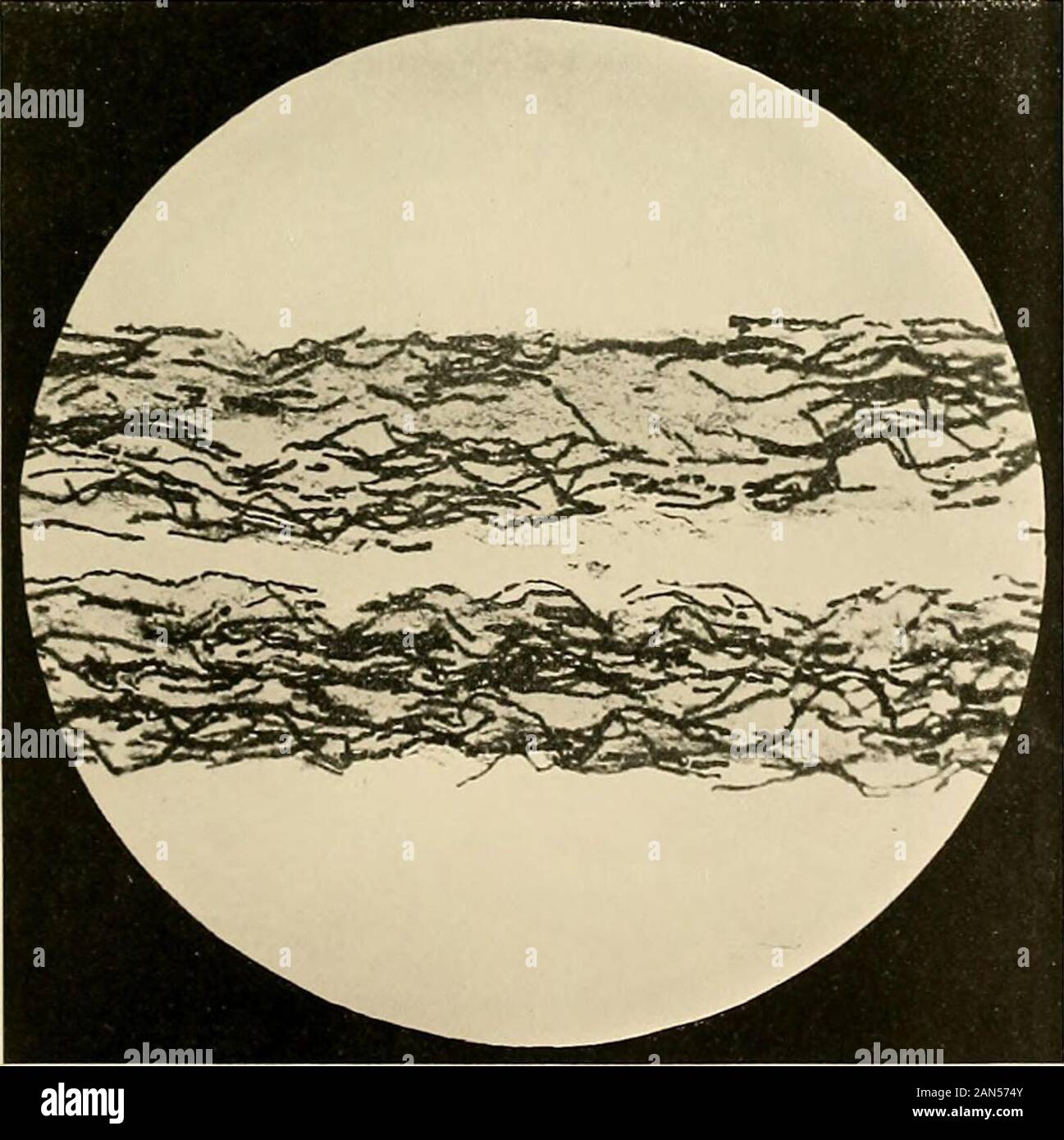 Ringworm scalp hi-res stock photography and images - Alamy