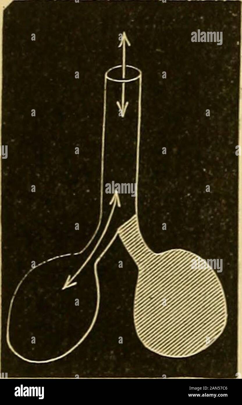 Stasis tube hi-res stock photography and images - Alamy