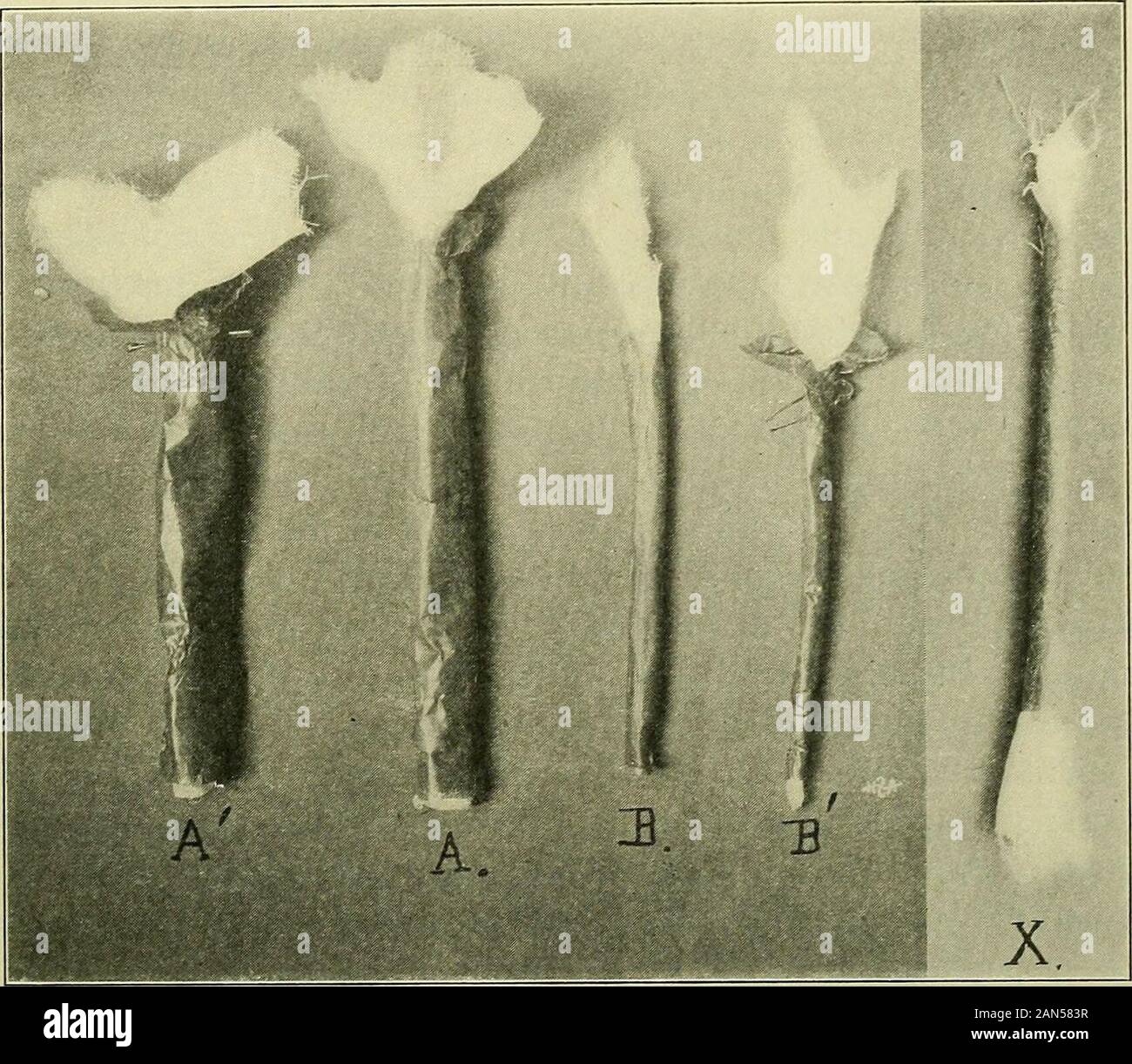 Fowler's position hi-res stock photography and images - Alamy