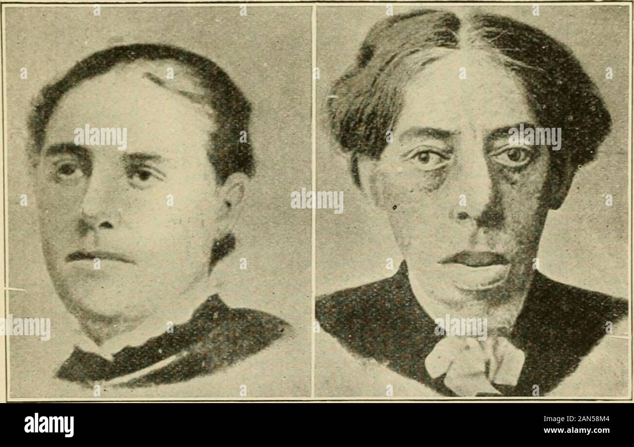 Pituitrin hi-res stock photography and images - Alamy