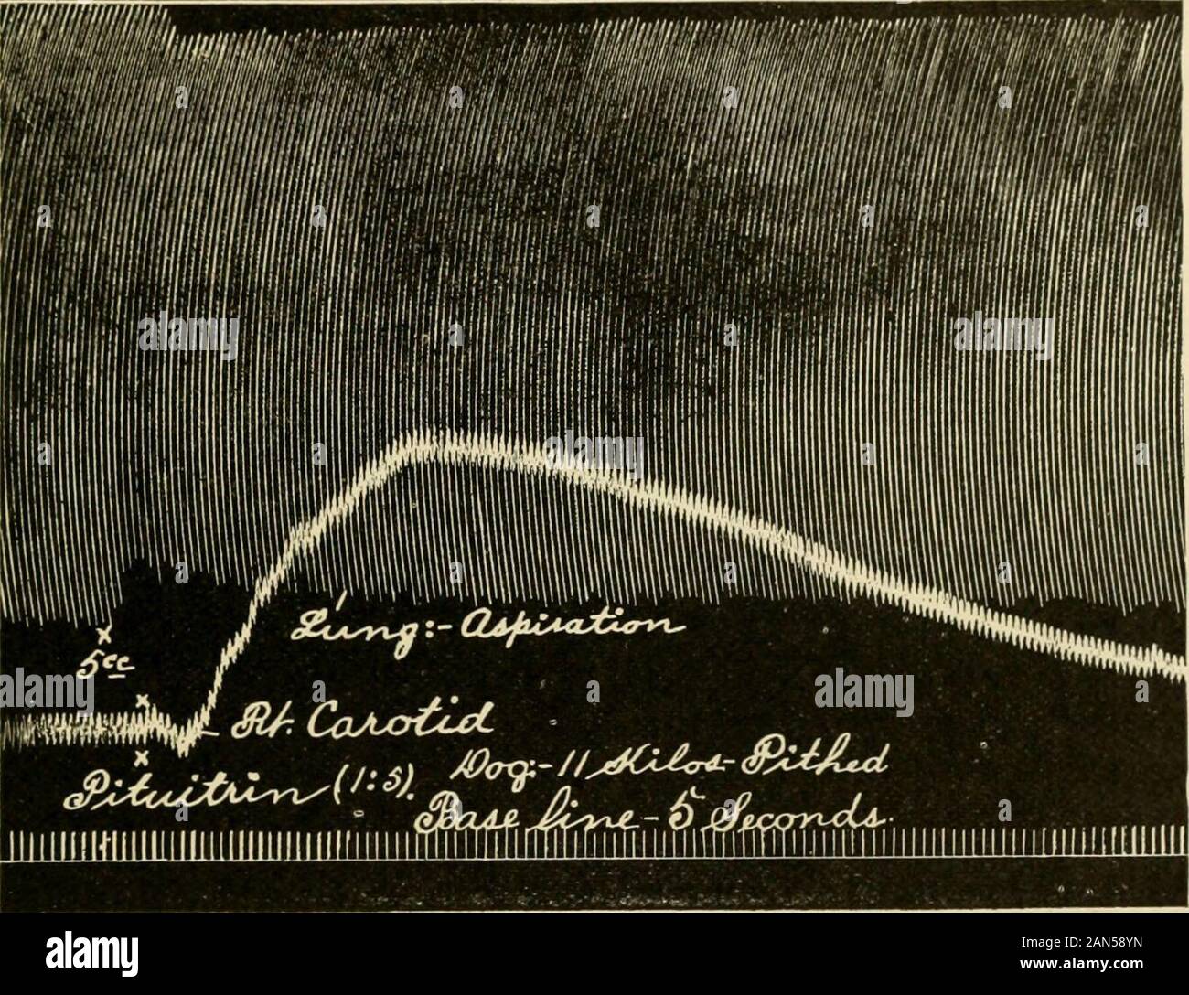 Pituitrin hi-res stock photography and images - Alamy