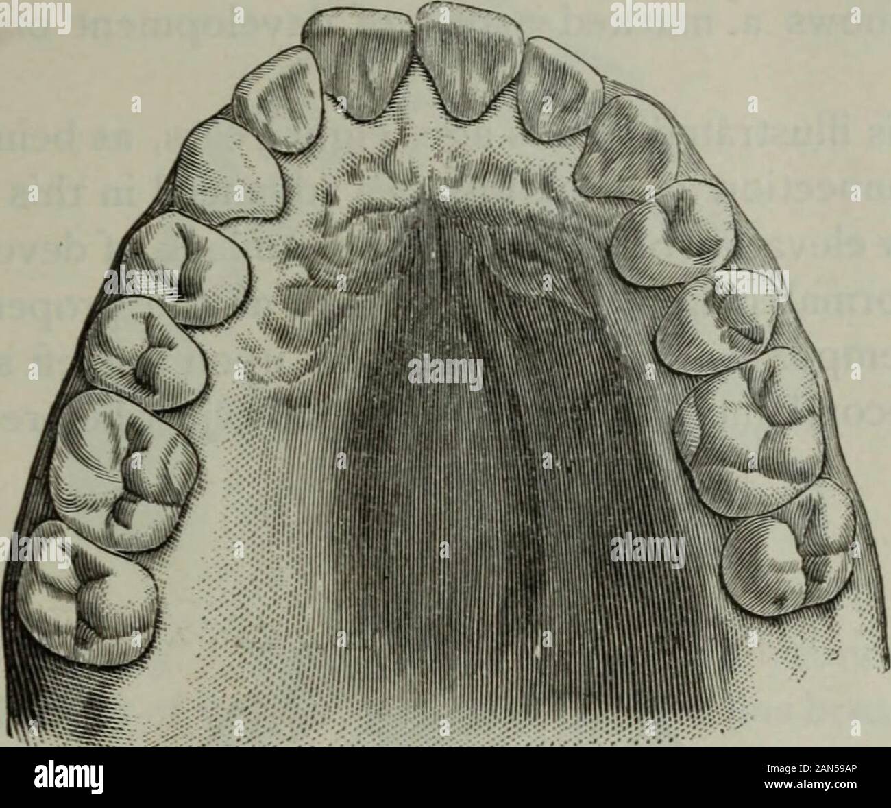 Maxillary bones hi-res stock photography and images - Alamy