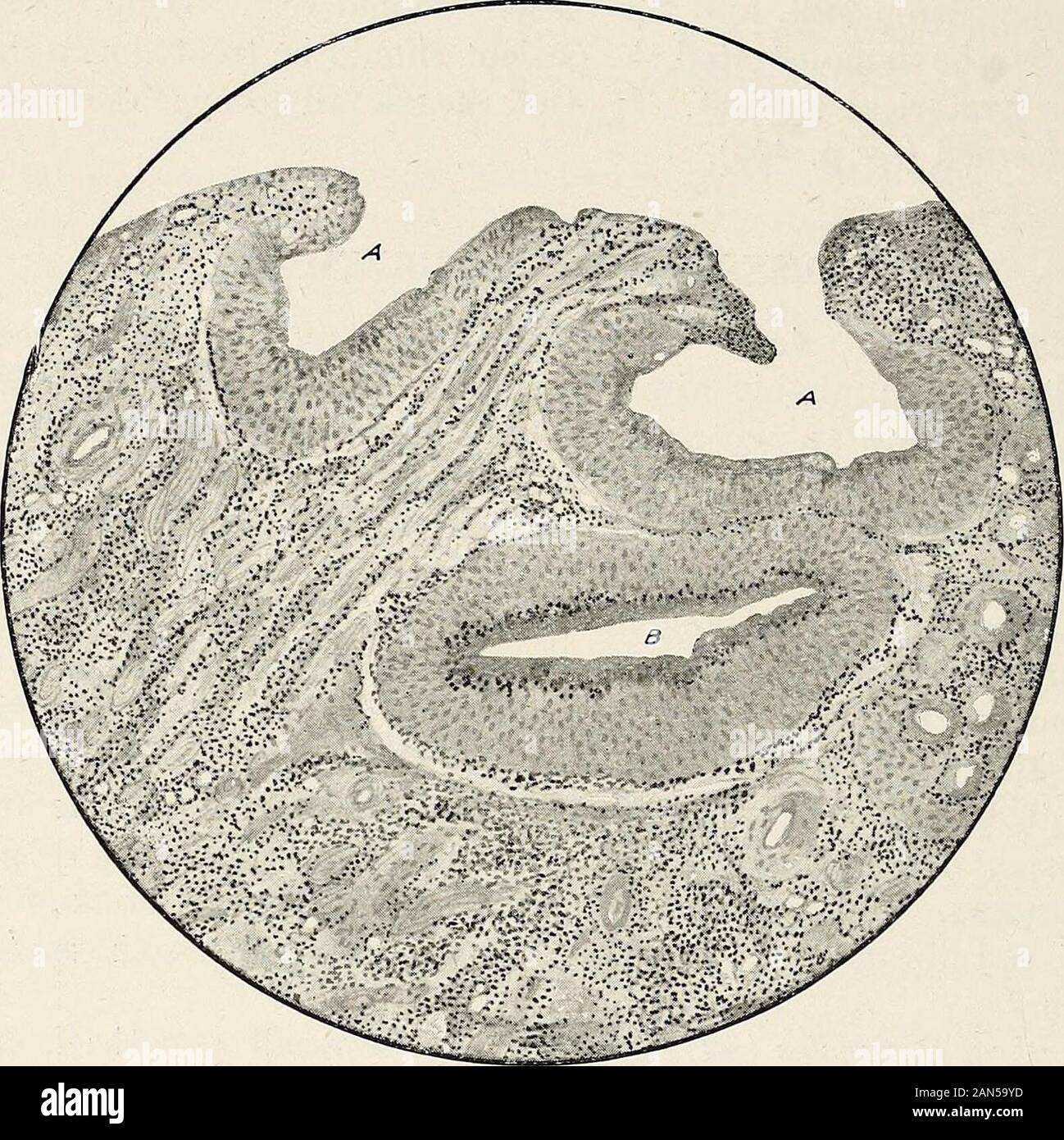 Urethral meatus hi-res stock photography and images - Alamy