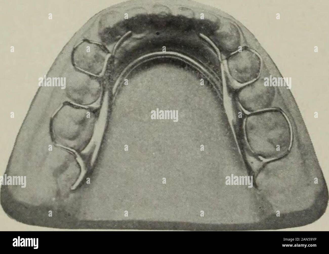 The Dental cosmos . very large, and the cheek bones promi-nent. The ...