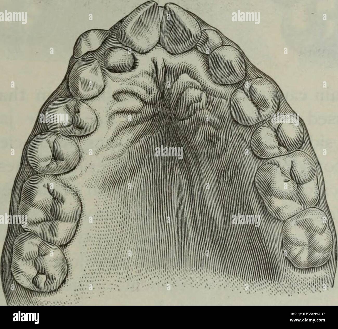 Deformed teeth hi-res stock photography and images - Alamy