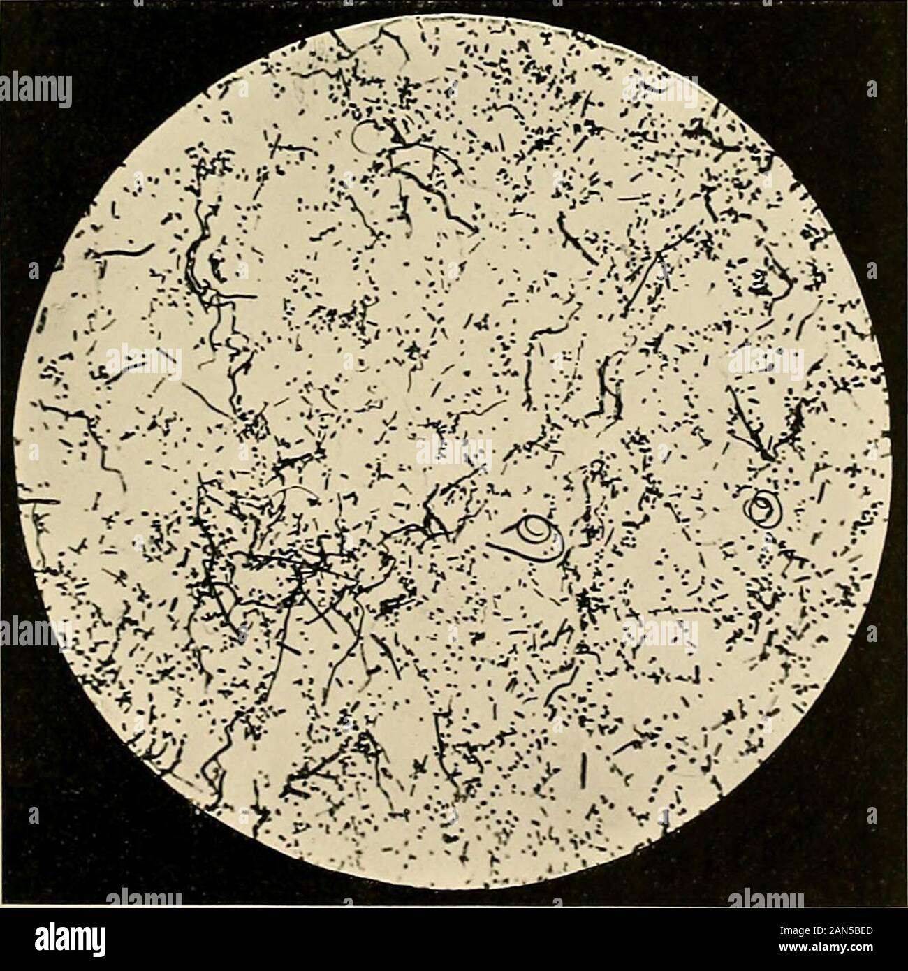 Ringworm Microscope