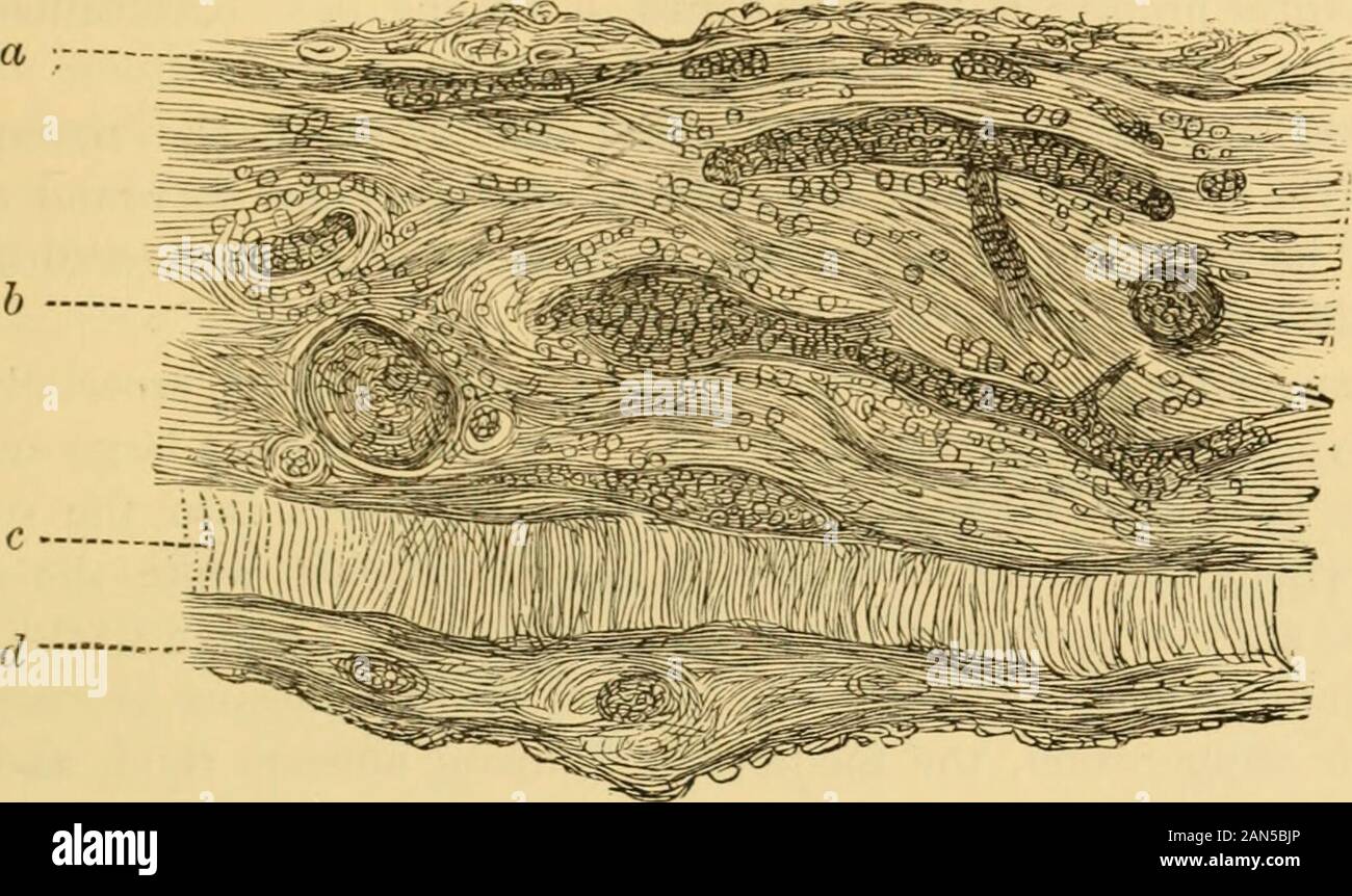 Purulent exudate hi-res stock photography and images - Alamy