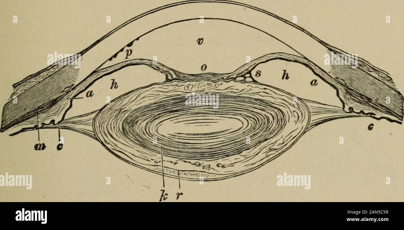 Synechia hi-res stock photography and images - Alamy
