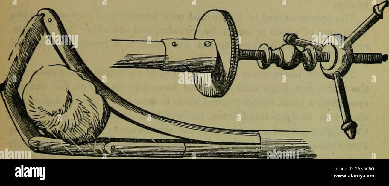 Trochar hi-res stock photography and images - Alamy