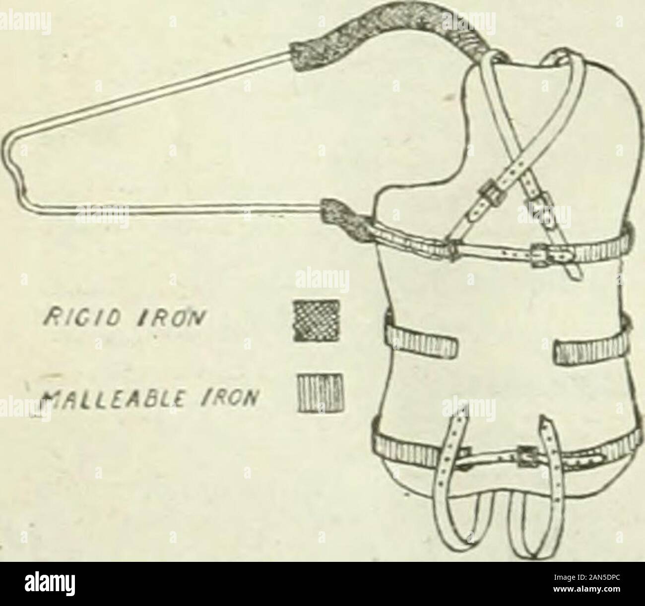 British medical journal . y bending the malleable iron bands to the con ...