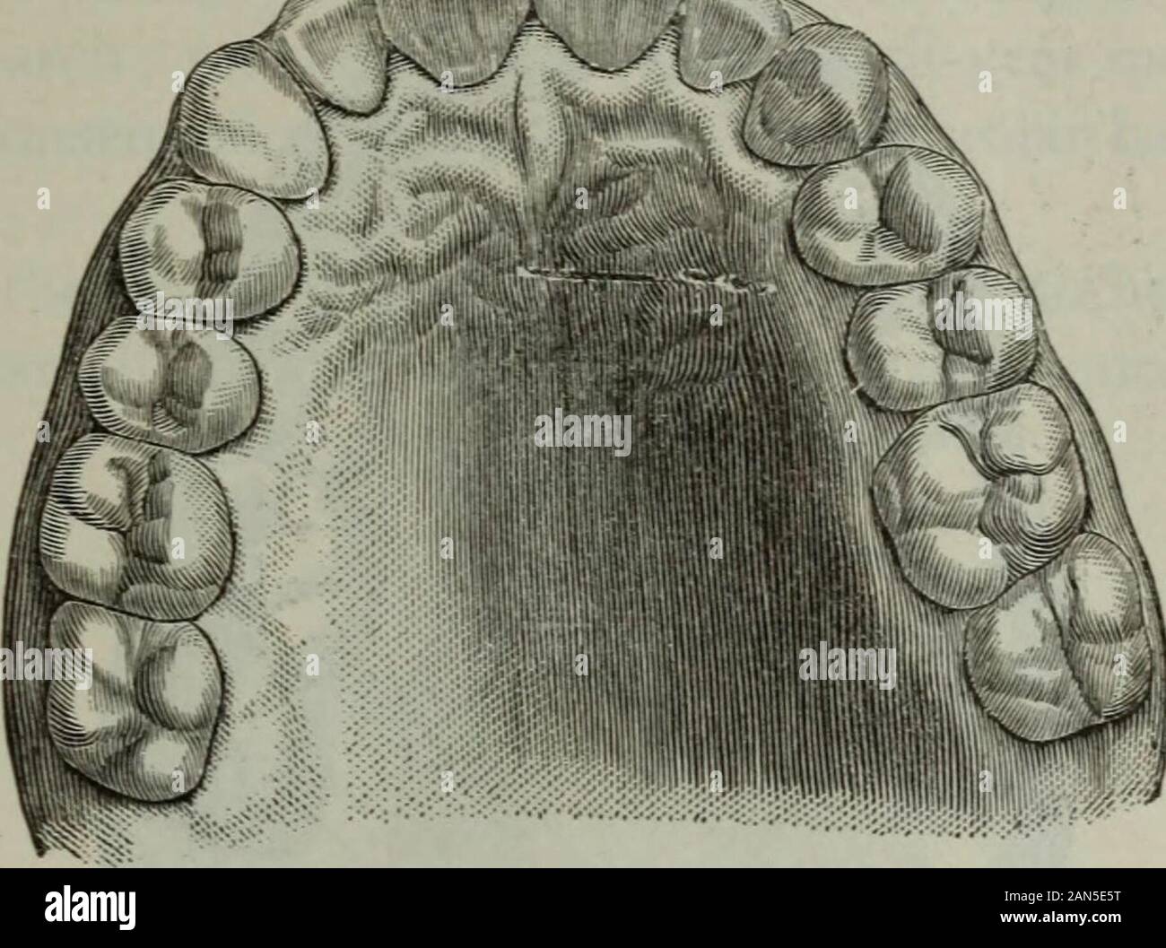 The Dental cosmos . MOUTH-BREATHING, ETC. 933 While the jaw is not ...