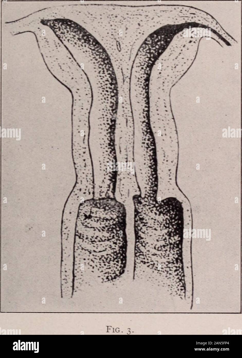 Transactions of the American Association of Obstetricians and ...