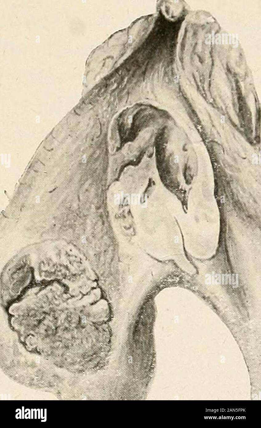 Labium majus hi-res stock photography and images - Alamy