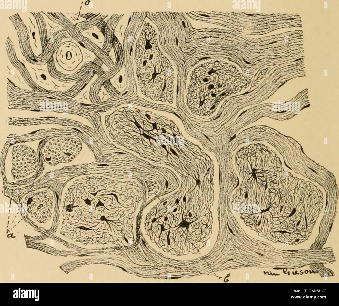 Insular in the brain hi-res stock photography and images - Alamy