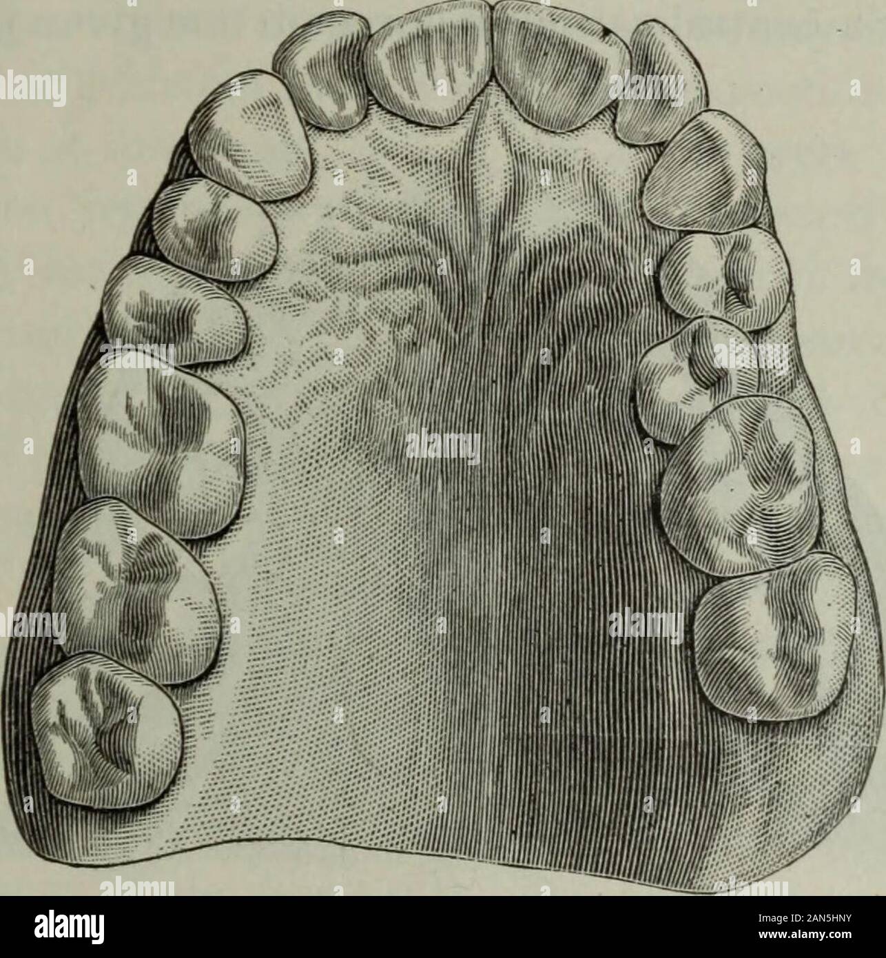 The Dental cosmos . for the weight of a building to break the arch of a ...
