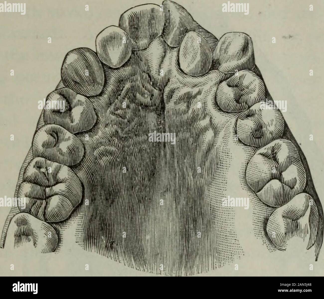 Superior maxilla hi-res stock photography and images - Alamy