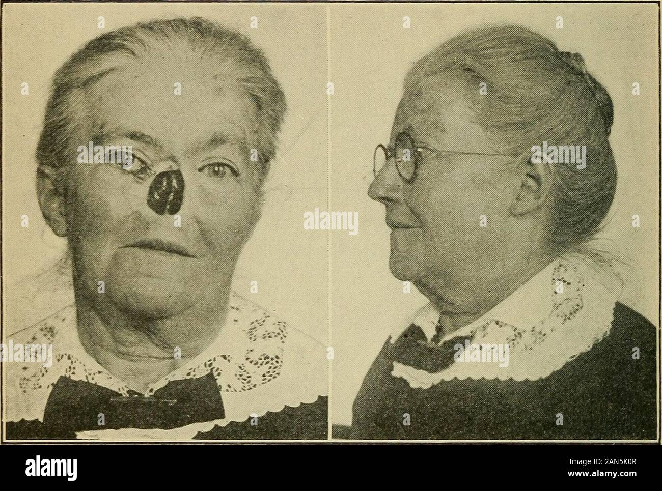 Reclaiming the maimed; a handbook of physical therapy . Fig. 114 ...