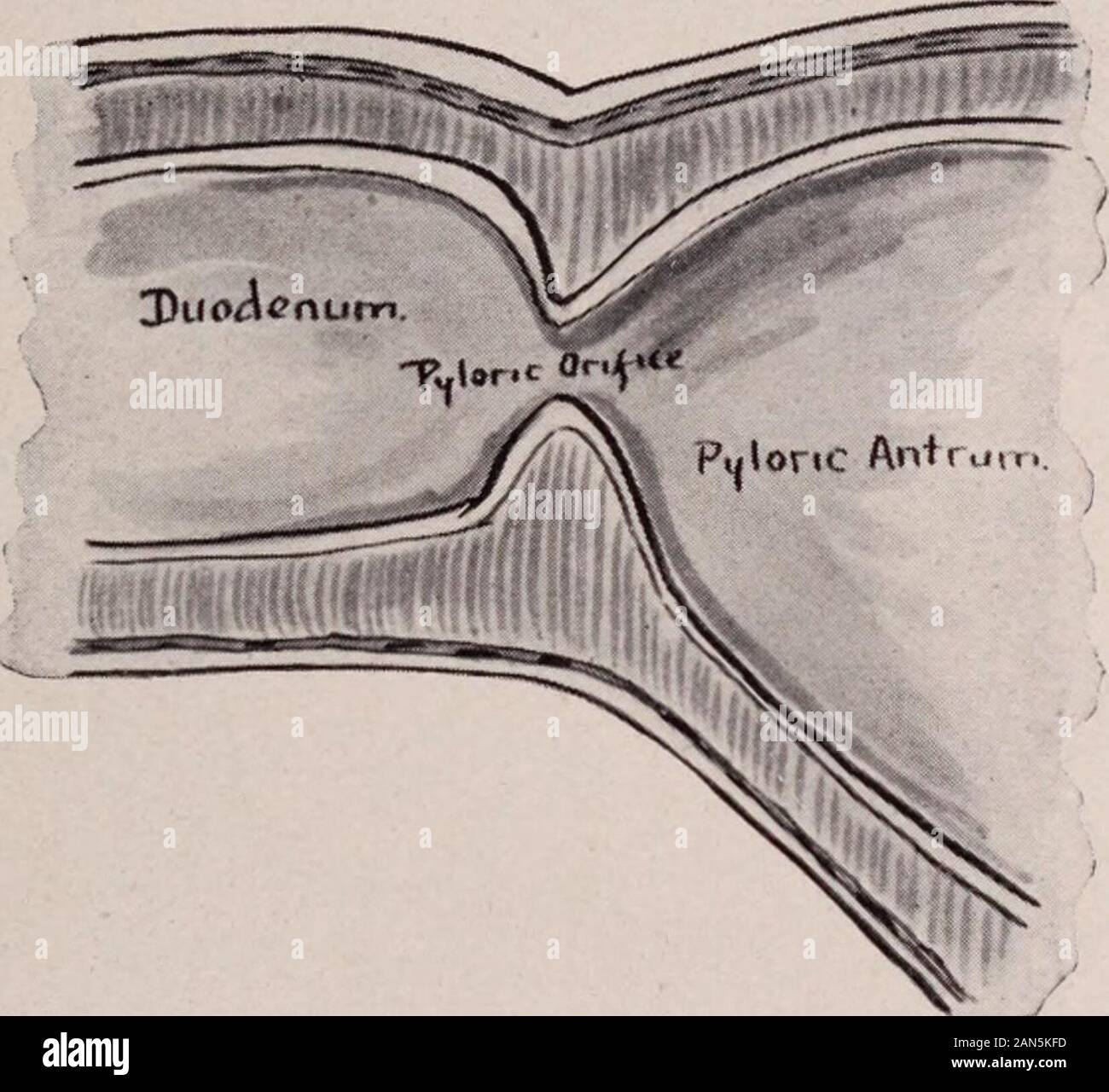 Y incision hi-res stock photography and images - Alamy