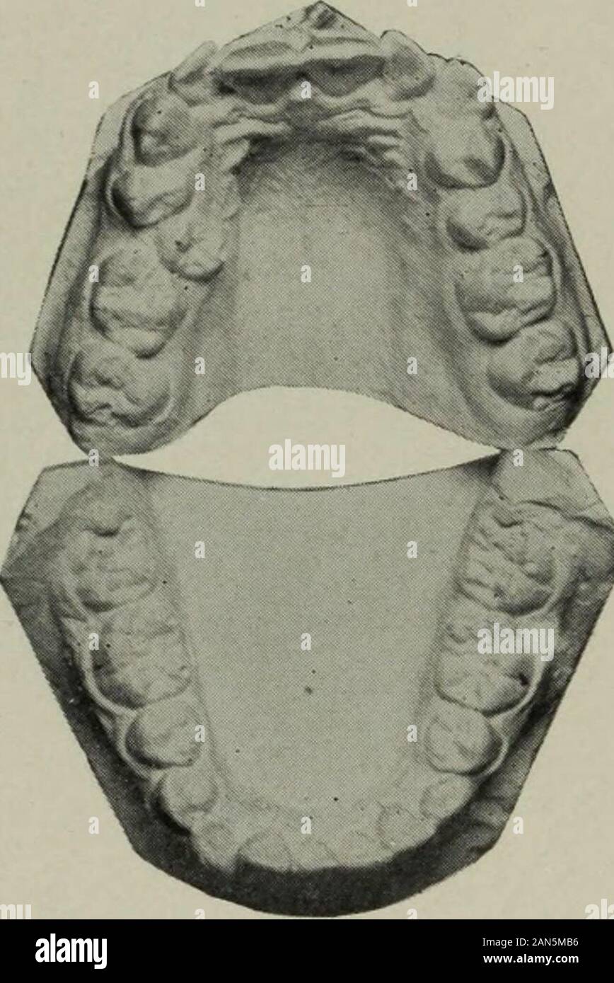 The Dental cosmos . in produ-cing caries or pyorrhea, depends ...