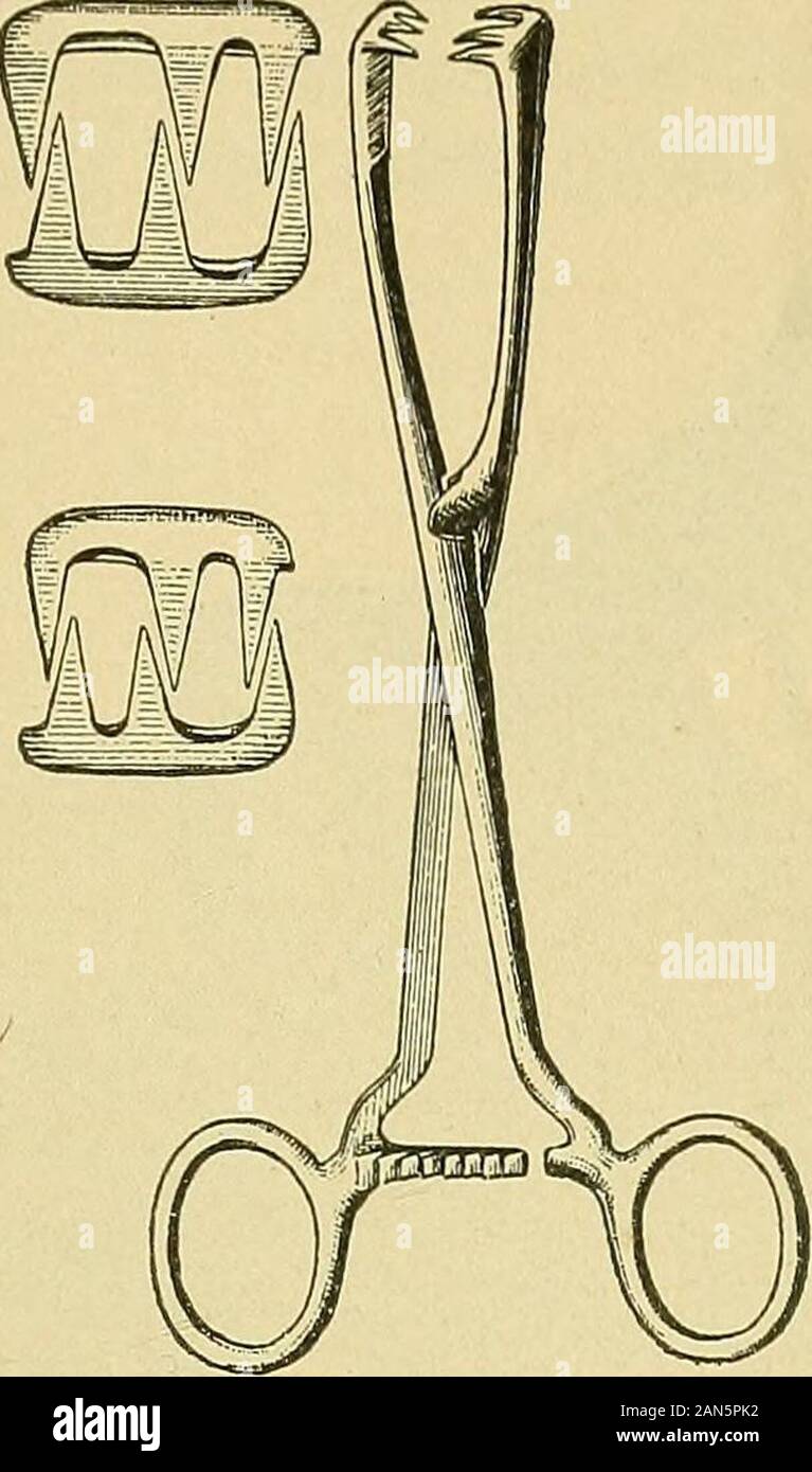 Pathology and treatment of diseases of women . Fig. 30.—MuzeuxForceps ...