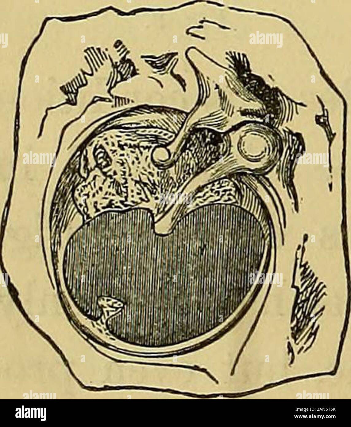 The membrana tympani in health and disease : clinical contributions to ...