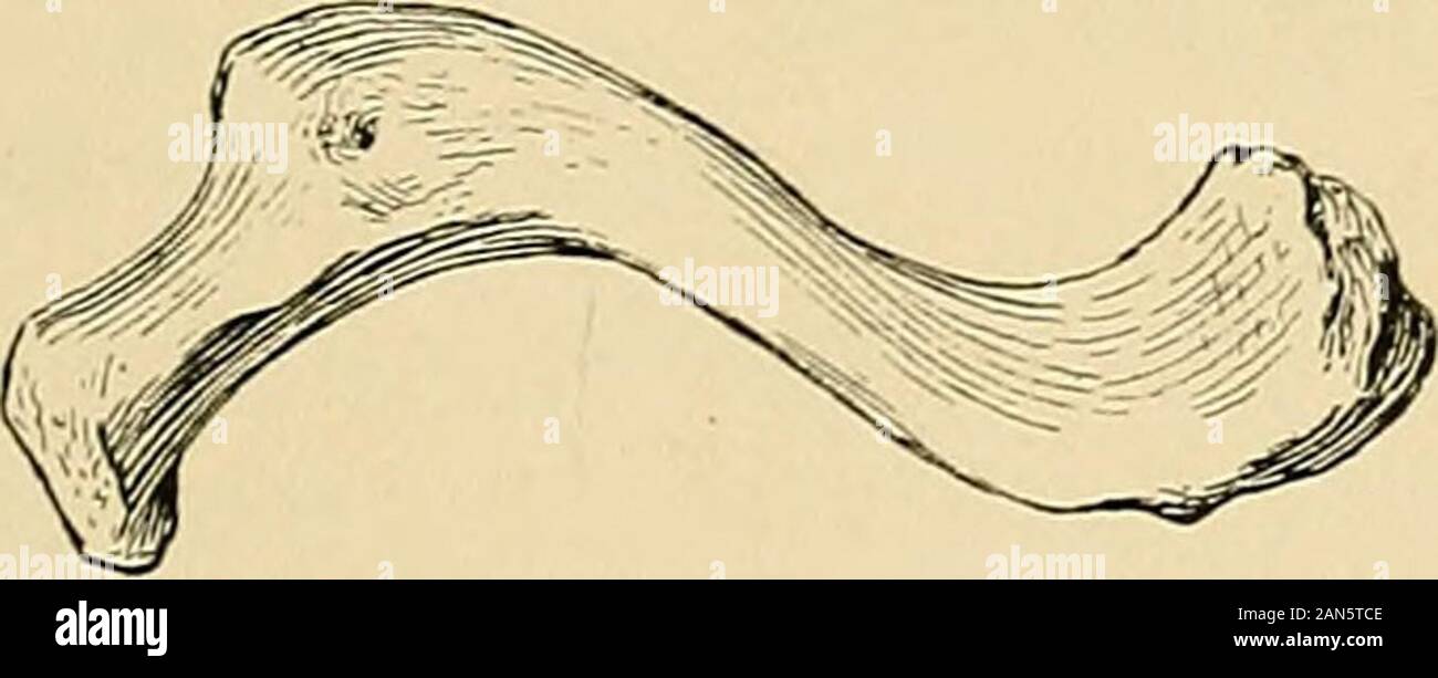 The treatment of fractures . ne in which the • l.u icle lies. X points ...