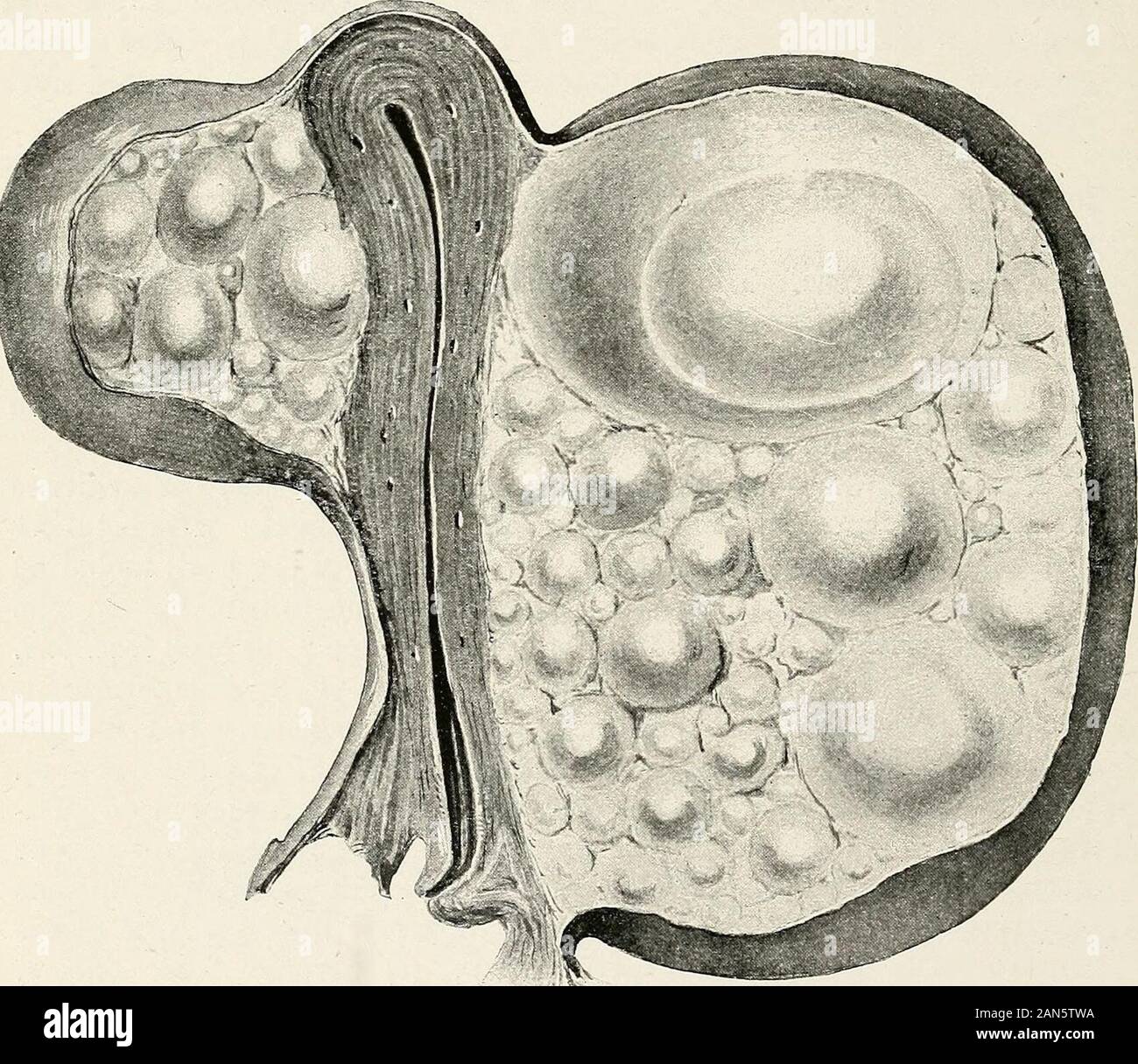 Gynaecology for students and practitioners . Fig. 156. Secondary ...