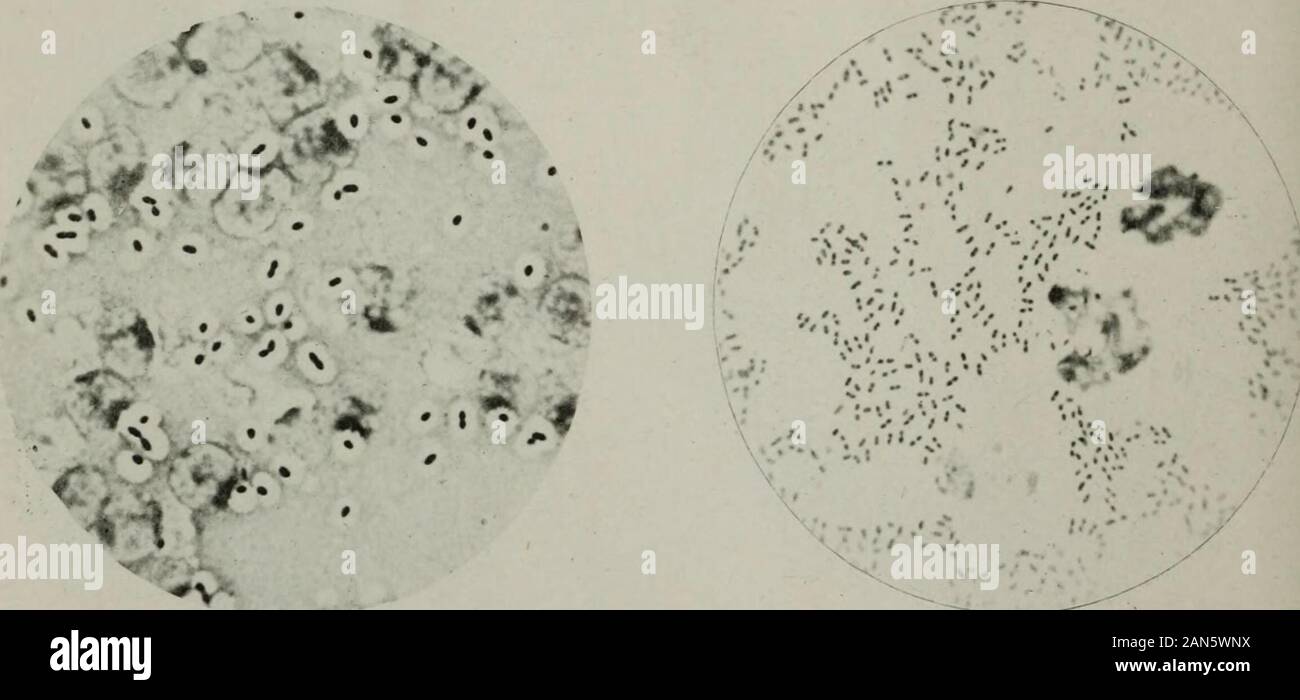 Micrococcus hi-res stock photography and images - Alamy