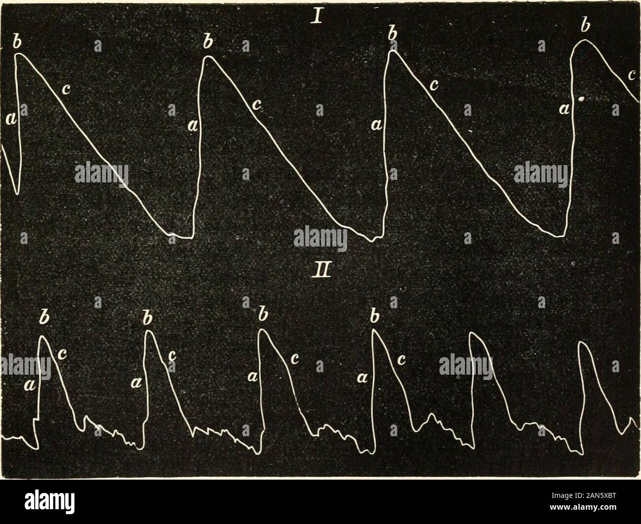 Stethograph hi-res stock photography and images - Alamy