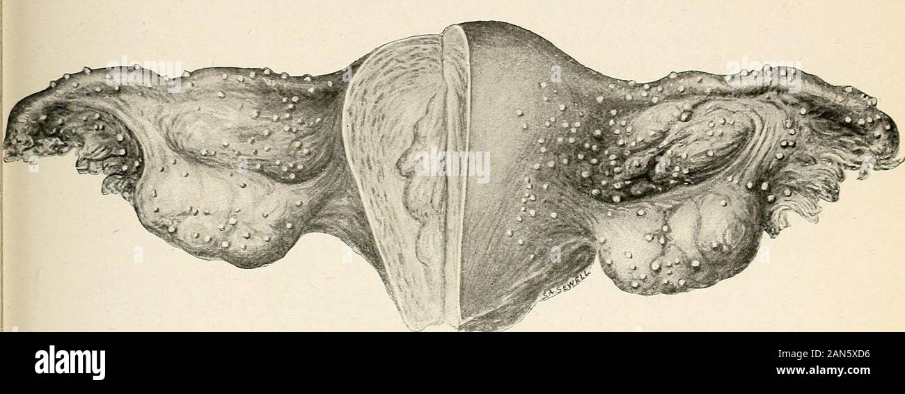 Gynaecology for students and practitioners . us abscess should never be ...