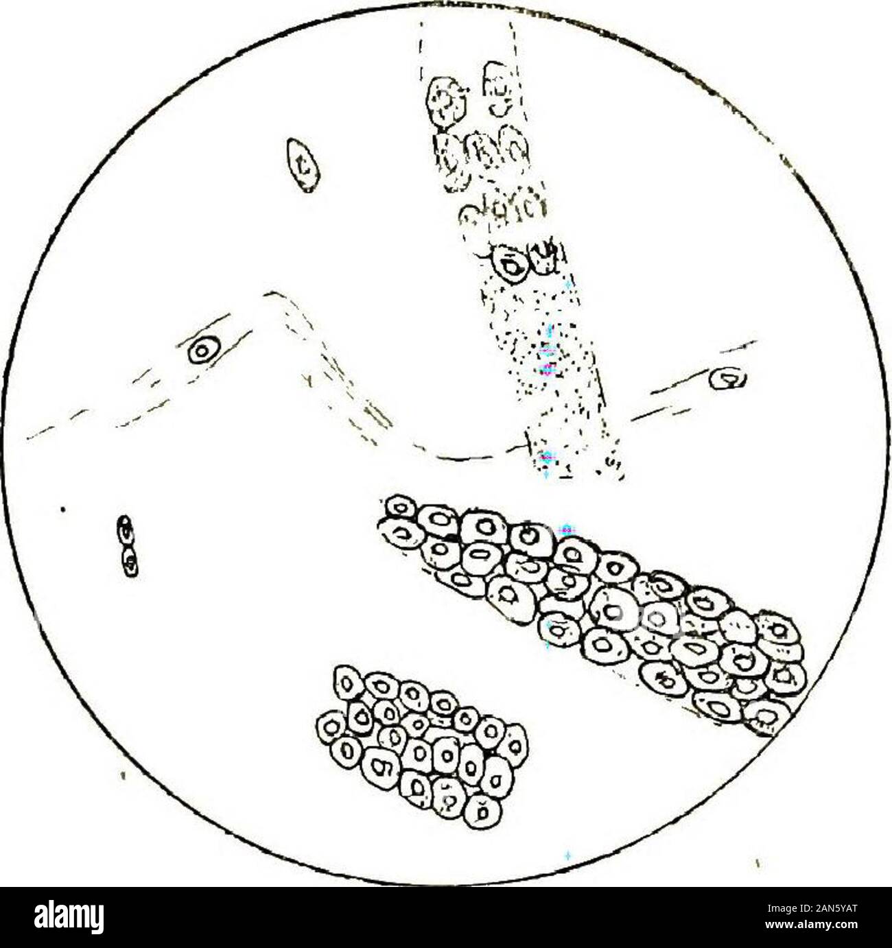 Urinary sediment hi-res stock photography and images - Alamy