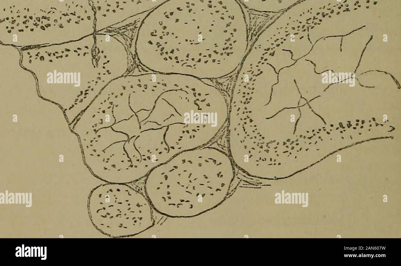 Variolitic hi-res stock photography and images - Alamy