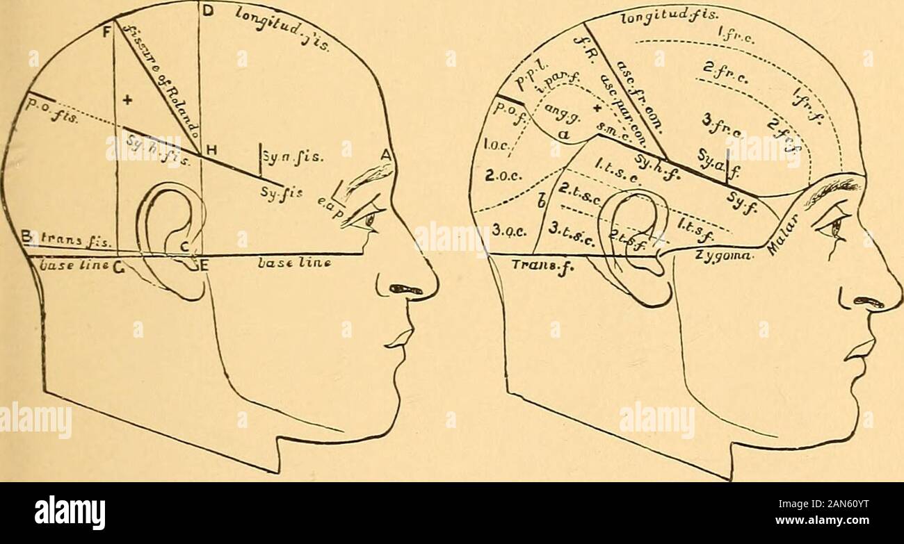 Brain surgery . Glabella Fig. (L— Diagram Showing the Measurements ...