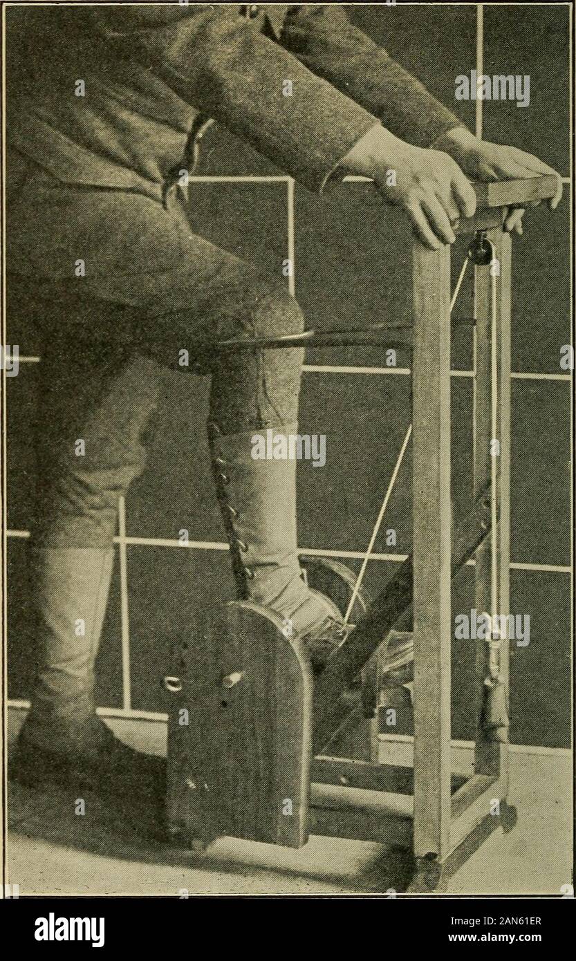 Reclaiming the maimed; a handbook of physical therapy . fiG. 76 ...