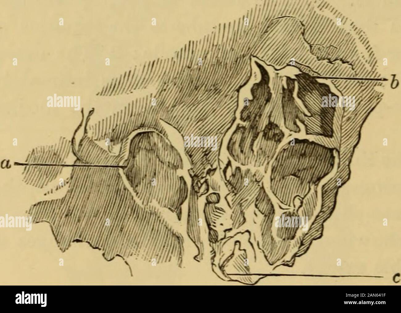 A text-book of the diseases of the ear and adjacent organs . POGRAPHY ...