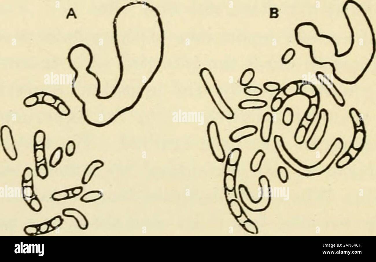 Pyloric sphincter hi-res stock photography and images - Alamy