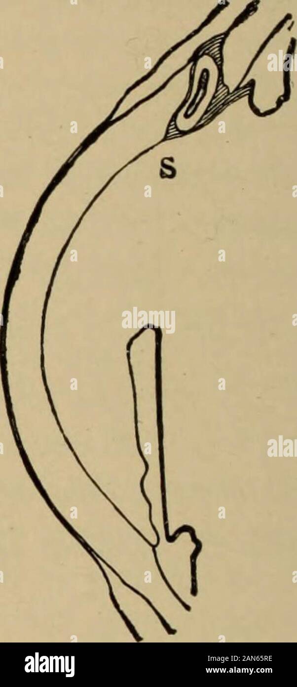 Text-book of ophthalmology . Fig. 129. Fig. 130. Fig. 129.—Rupture op ...