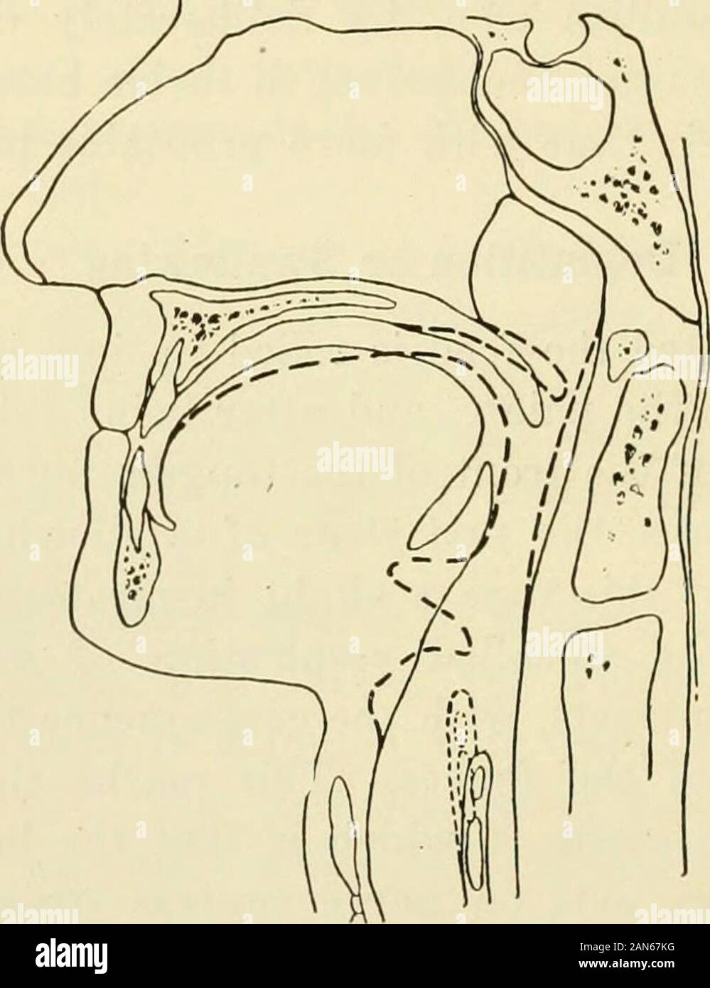 True And False Vocal Cords Model
