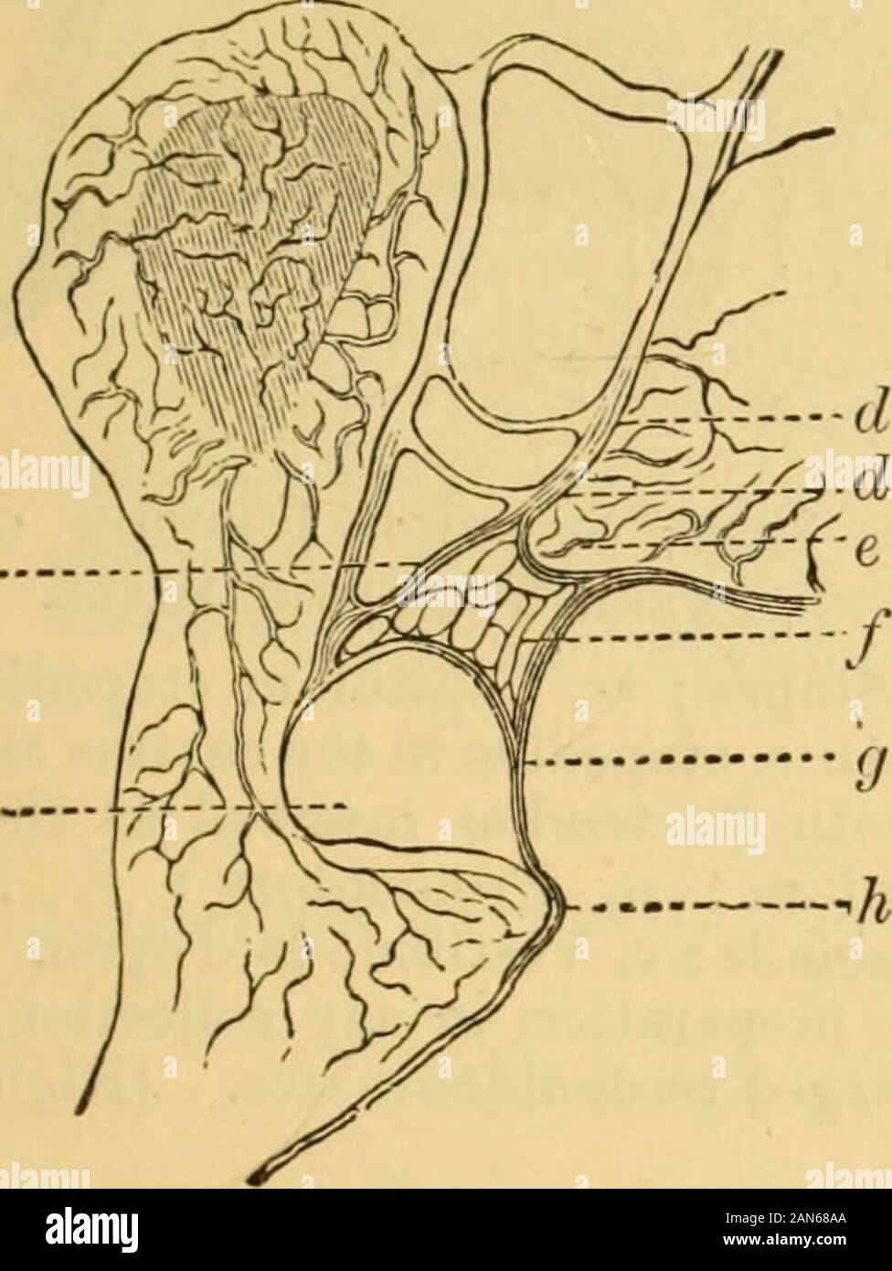 Tympanic membrane perforation hi-res stock photography and images - Alamy