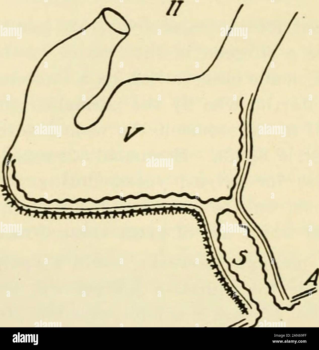 Alexis st martin stomach hi-res stock photography and images - Alamy