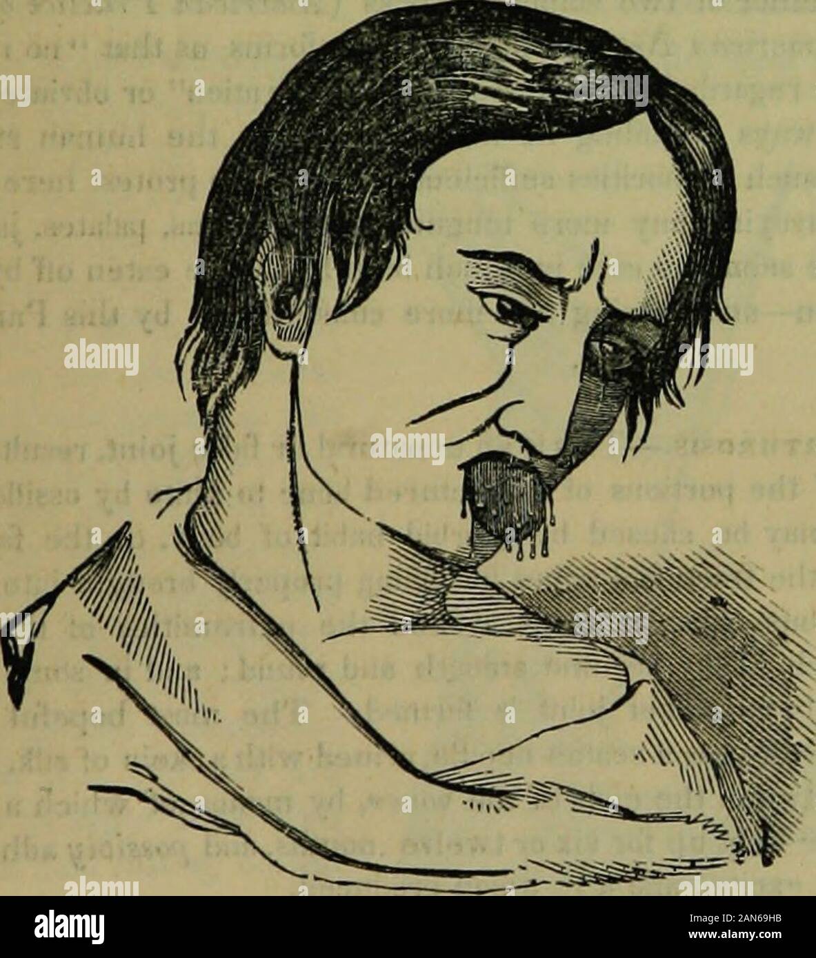 Scrofulous hi-res stock photography and images - Alamy