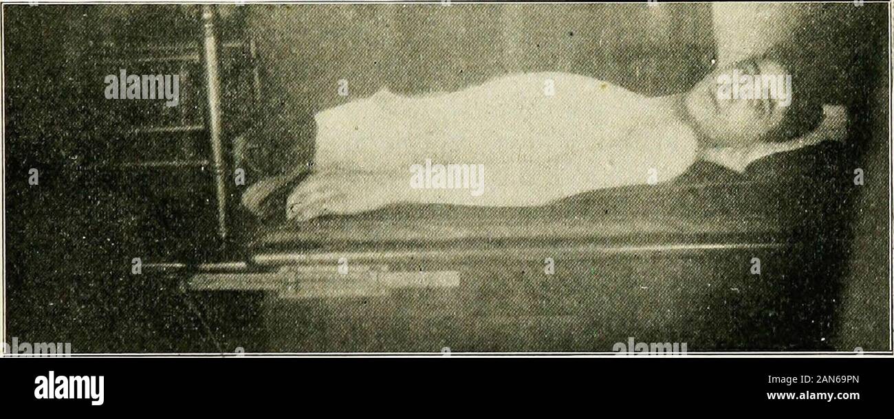 The signs of internal disease, with a brief consideration of the ...