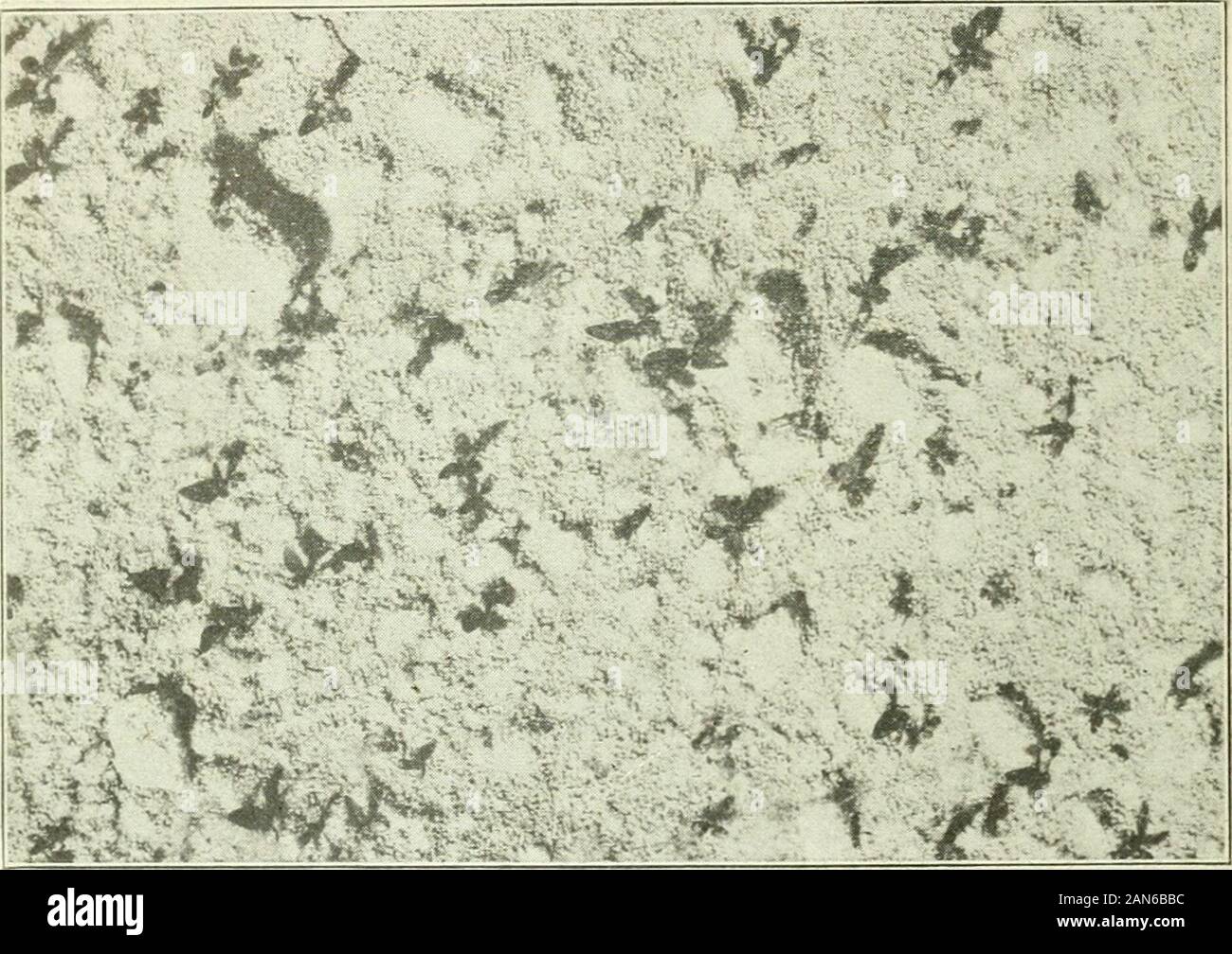 Tubercle bacteria hi-res stock photography and images - Alamy