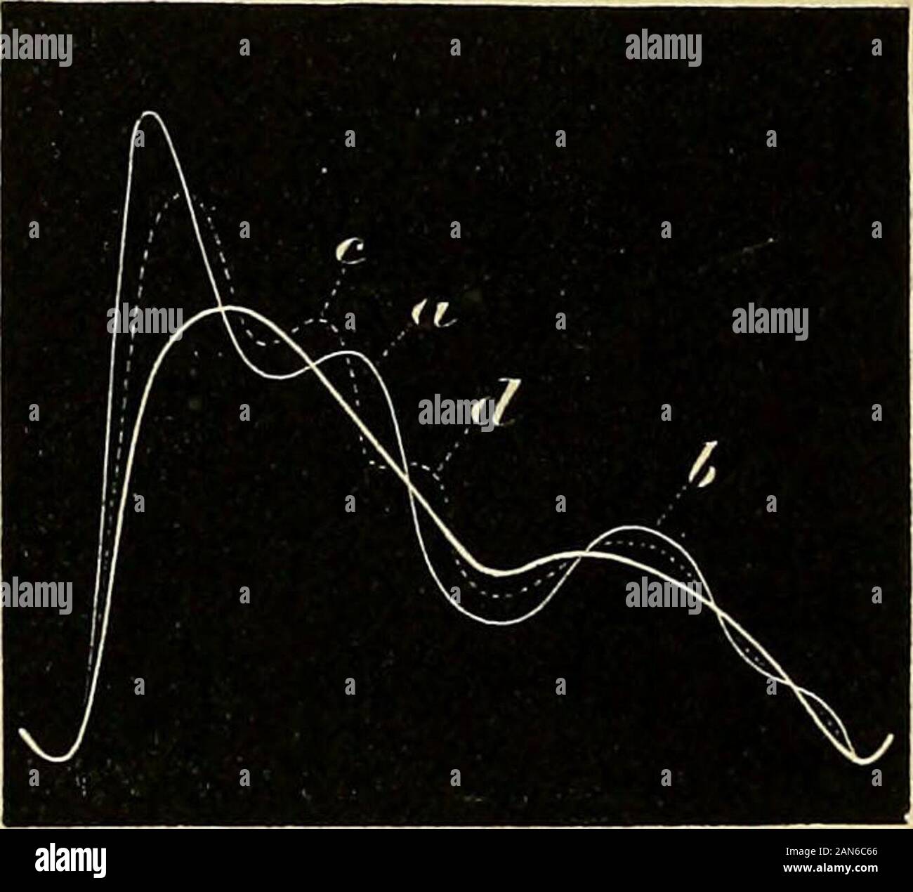 Elasticity of arteries hi-res stock photography and images - Alamy